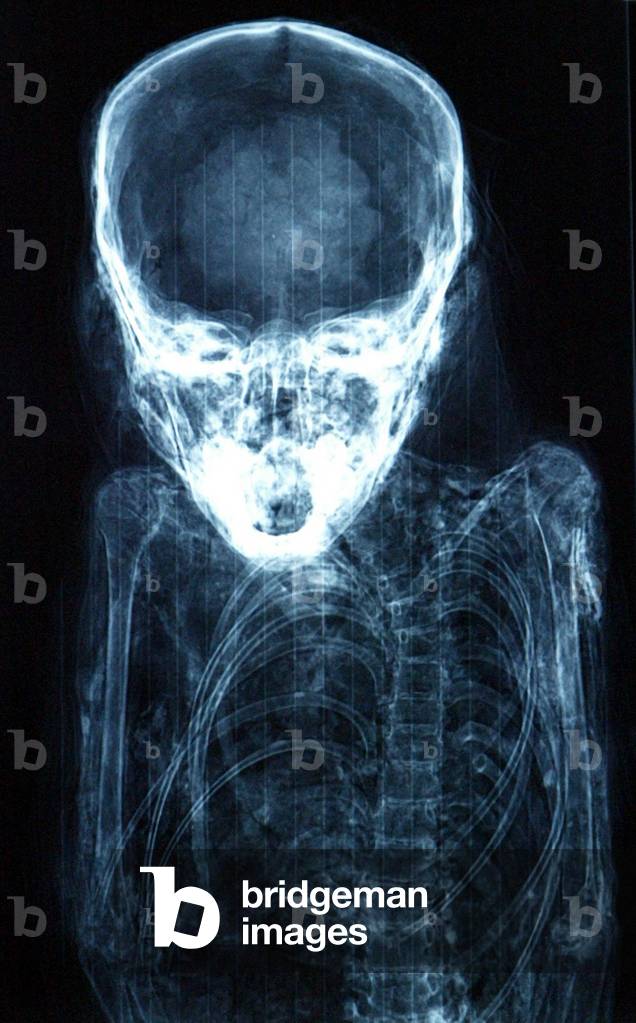 Image of THE X-RAY OF 3,000-YEAR-OLD EGYPTIAN MUMMY IS PUT ON DISPLAY