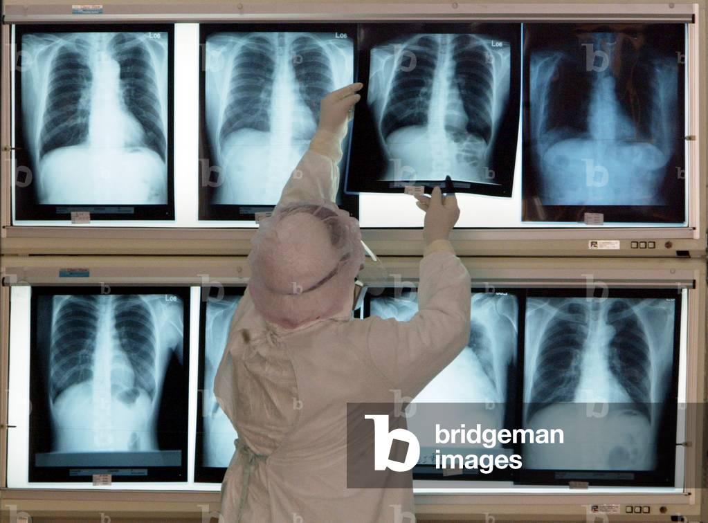 Image of A nurse checks chest x-rays for signs of Severe Acute