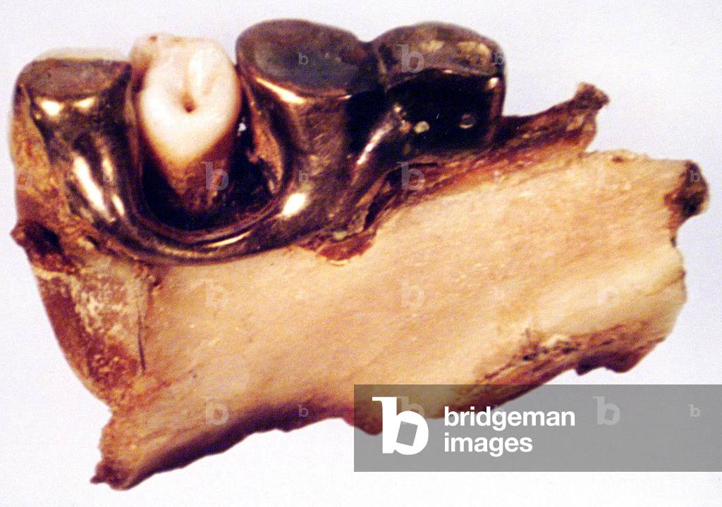 Image of A section of human jaw that experts say belonged to