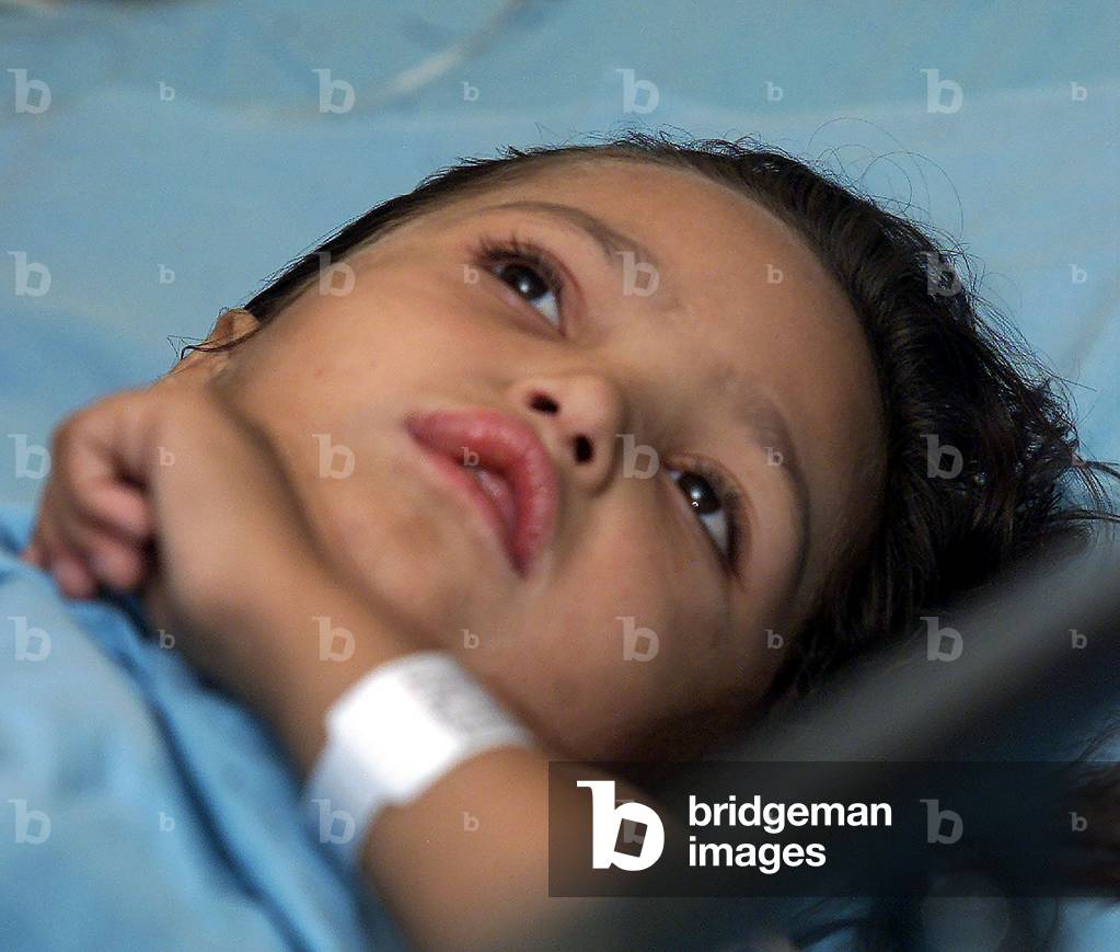 Image of PALESTINIAN GIRL FROM EAST JERUSALEM RECEIVES KIDNEY FROM ...