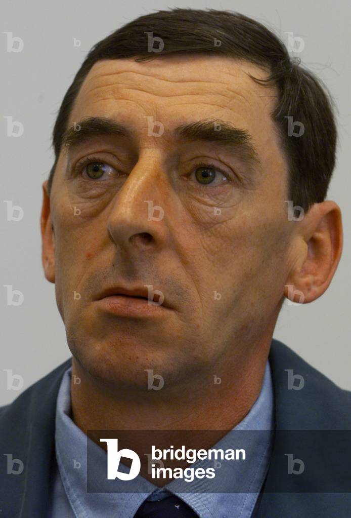 Image of French gendarme Daniel Nivel who was clubbed by German hooligans