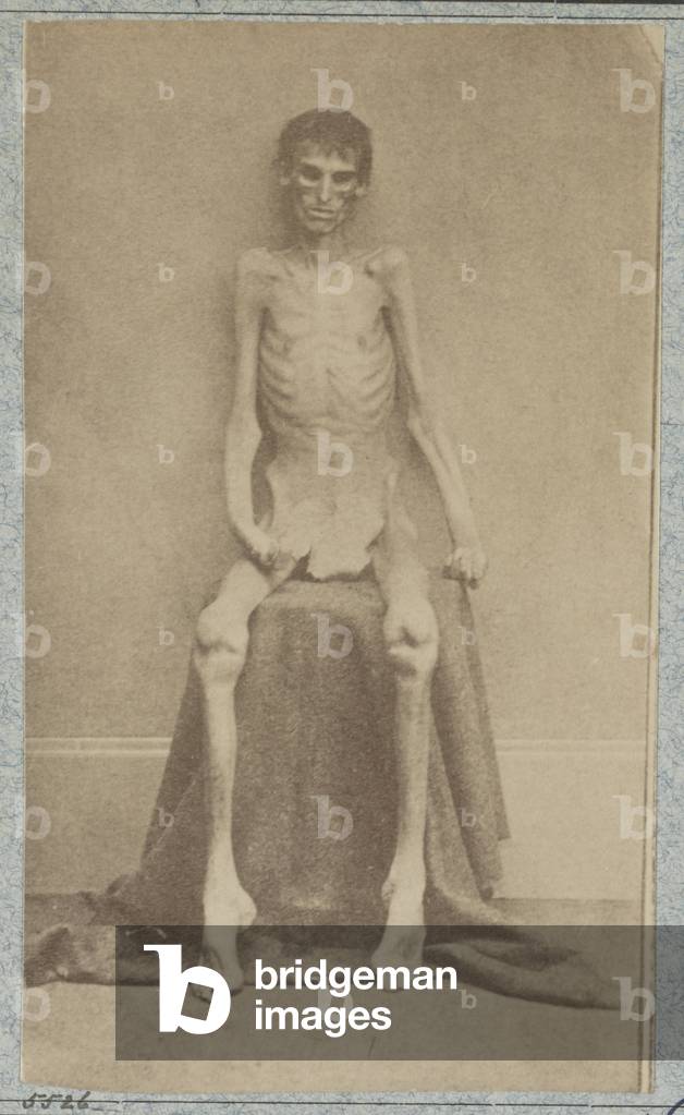 Giacomo And Giovanni Tocci