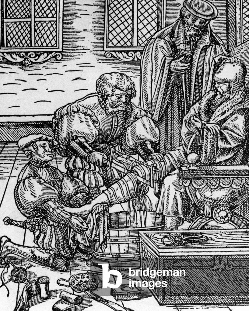 Image of "Die Amputation" ("The Amputation"), 1500