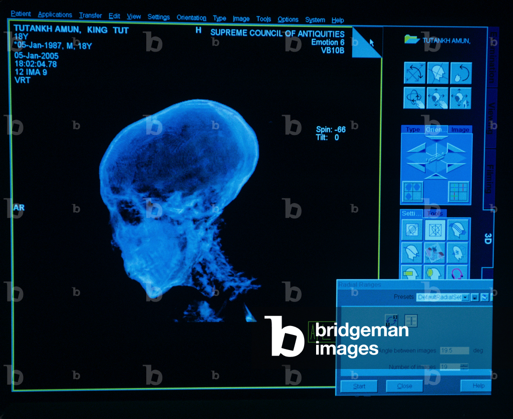 Image of CT scan monitor, test performed on mummy of Pharaoh ...