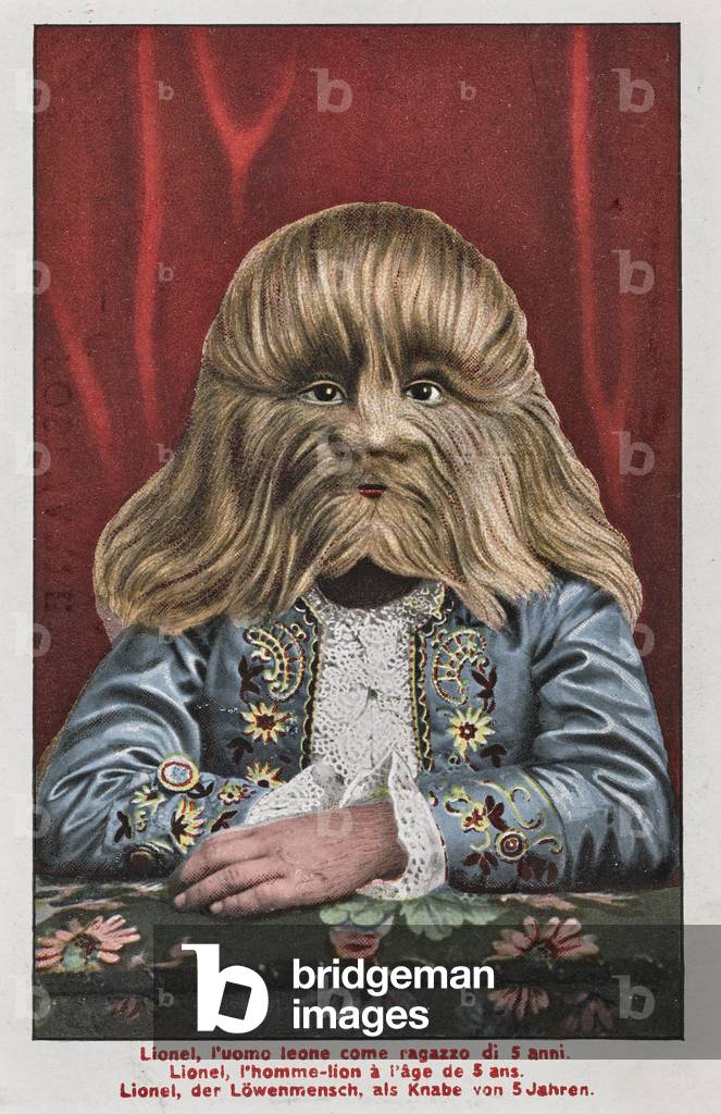 Lionel The Lion Faced Man