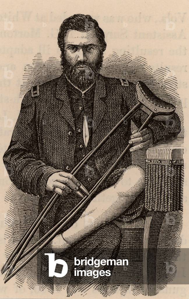 Image of Casualty displaying healed stump, 19th century (engraving)
