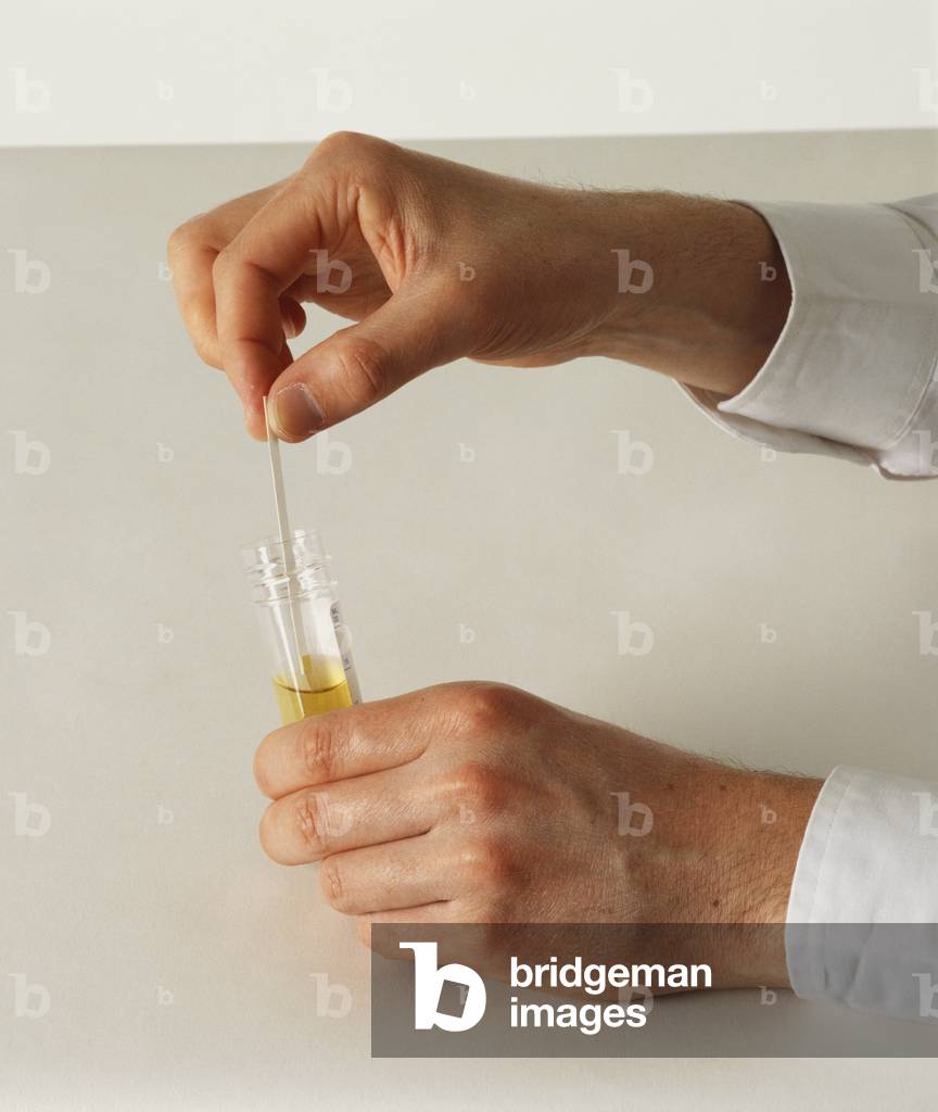Image of Testing strip being dipped into a urine sample.